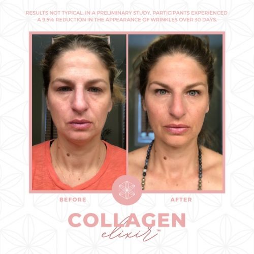 Collagen Transformation 37 - Healthy Body Team