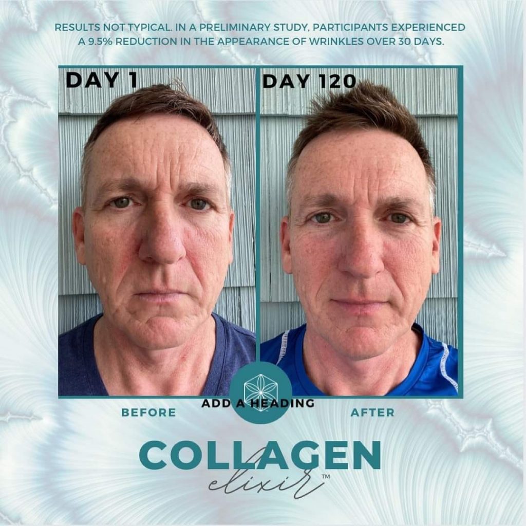 Collagen Transformation 38 - Healthy Body Team