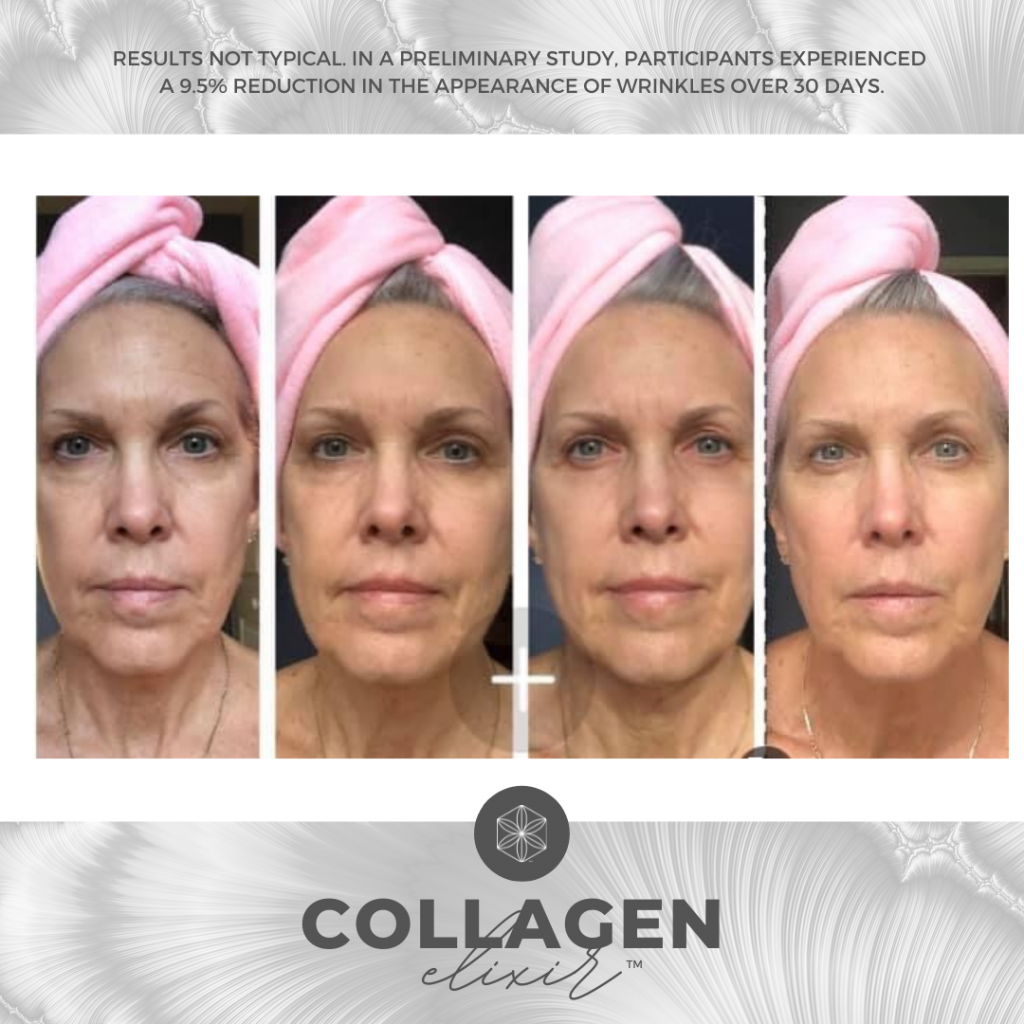 Collagen Transformation 39 - Healthy Body Team