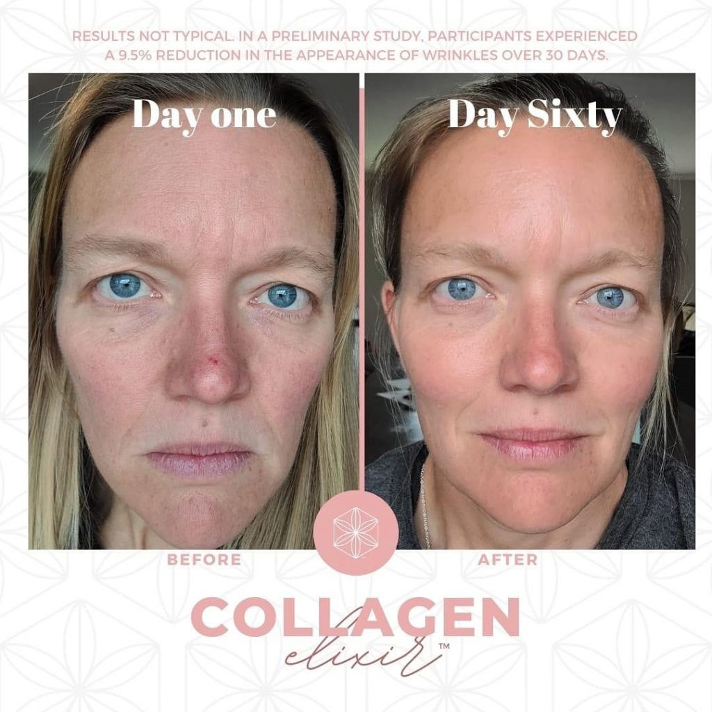 Collagen Transformation 46 - Healthy Body Team