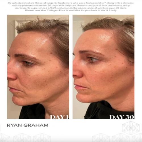 Collagen Transformation 66 - Ryan Graham - Healthy Body Team